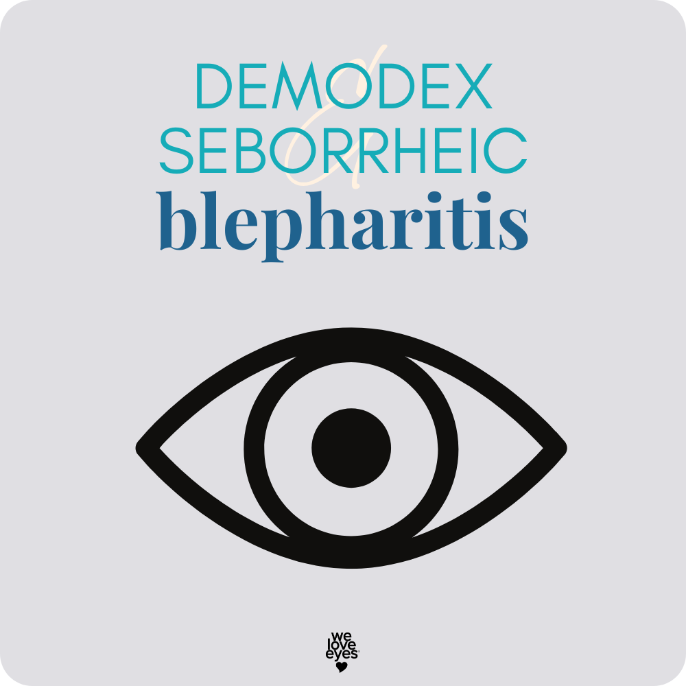 Demodex vs. Seborrheic BLEPHARITIS: Visual Examples and Treatment Tips ...