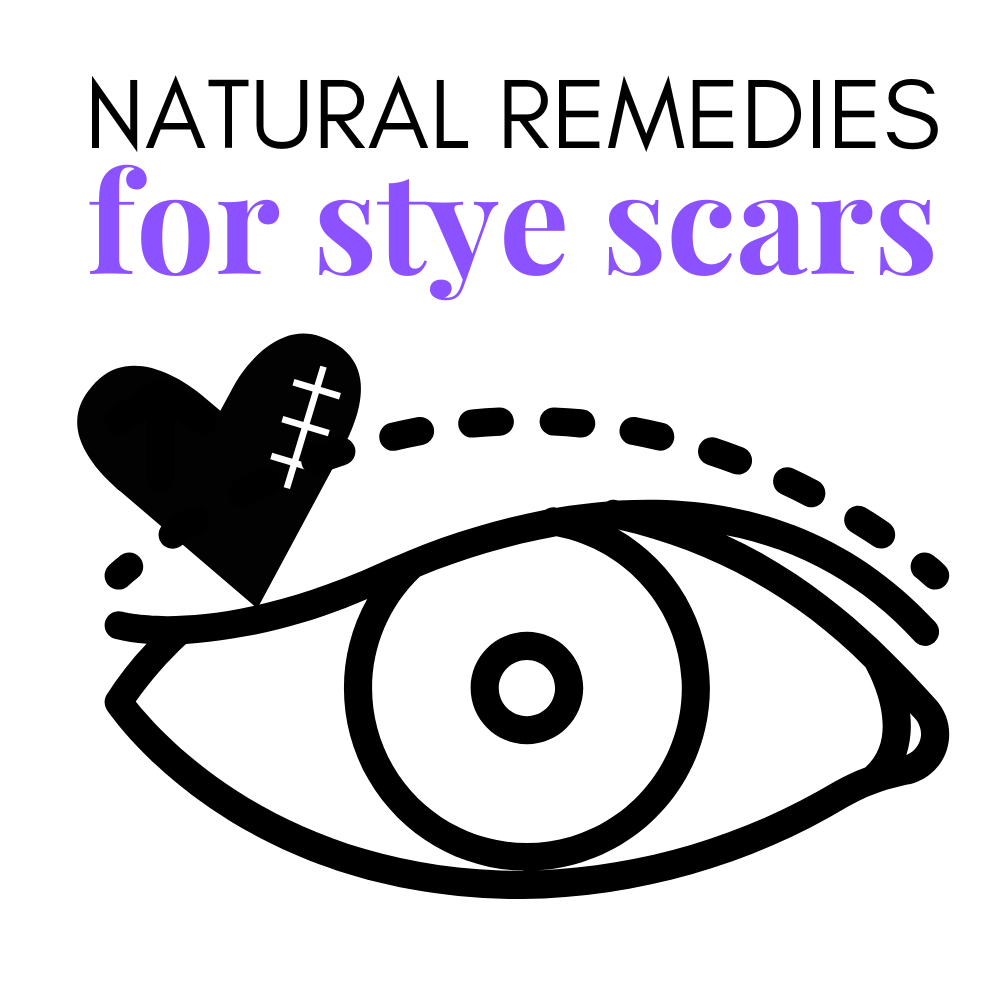 How to Treat and Heal a Stye Scar Naturally: Expert Tips from an Optom ...