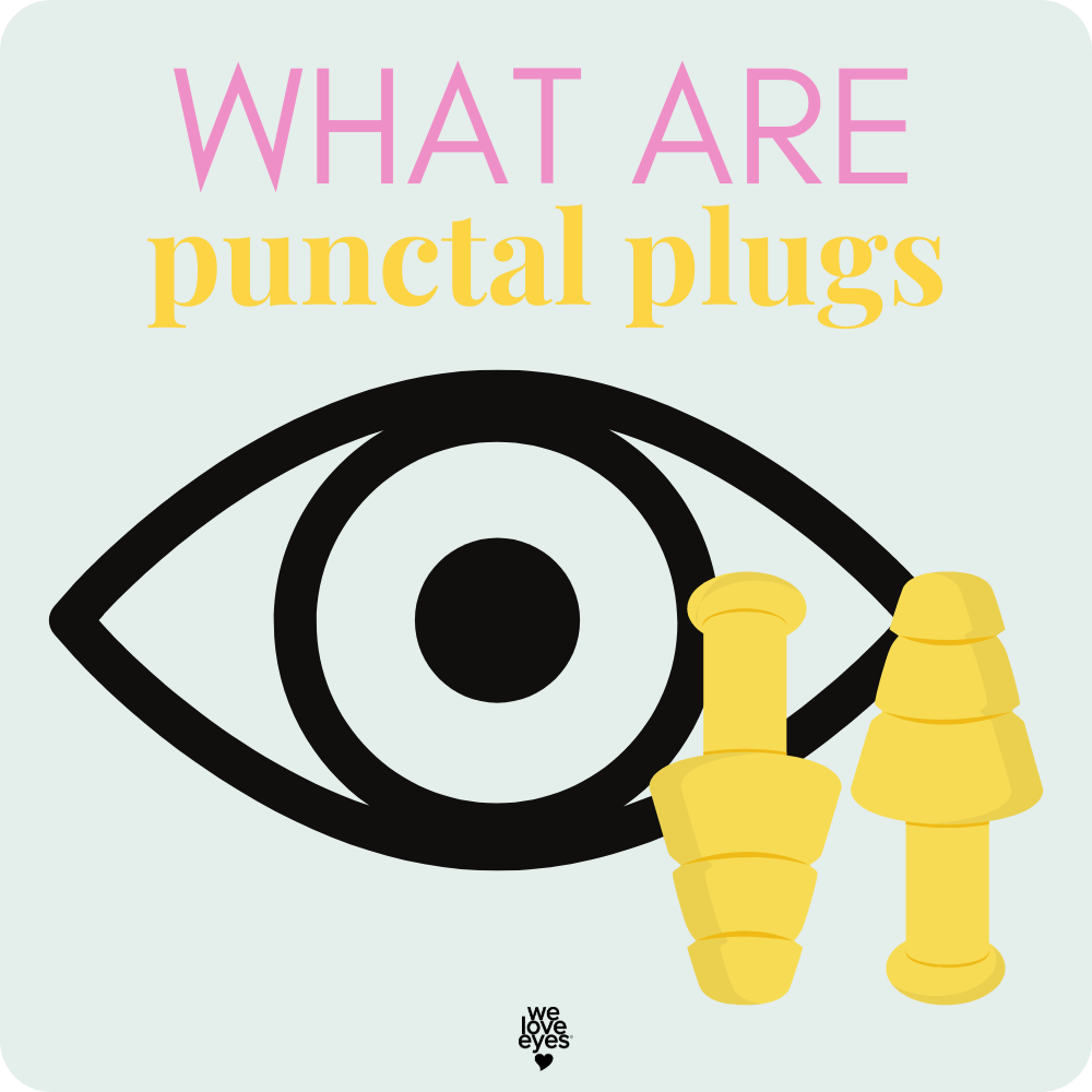 My Eye Doctor Said I Need Punctal Plugs. What Are Punctal Plugs? – We ...