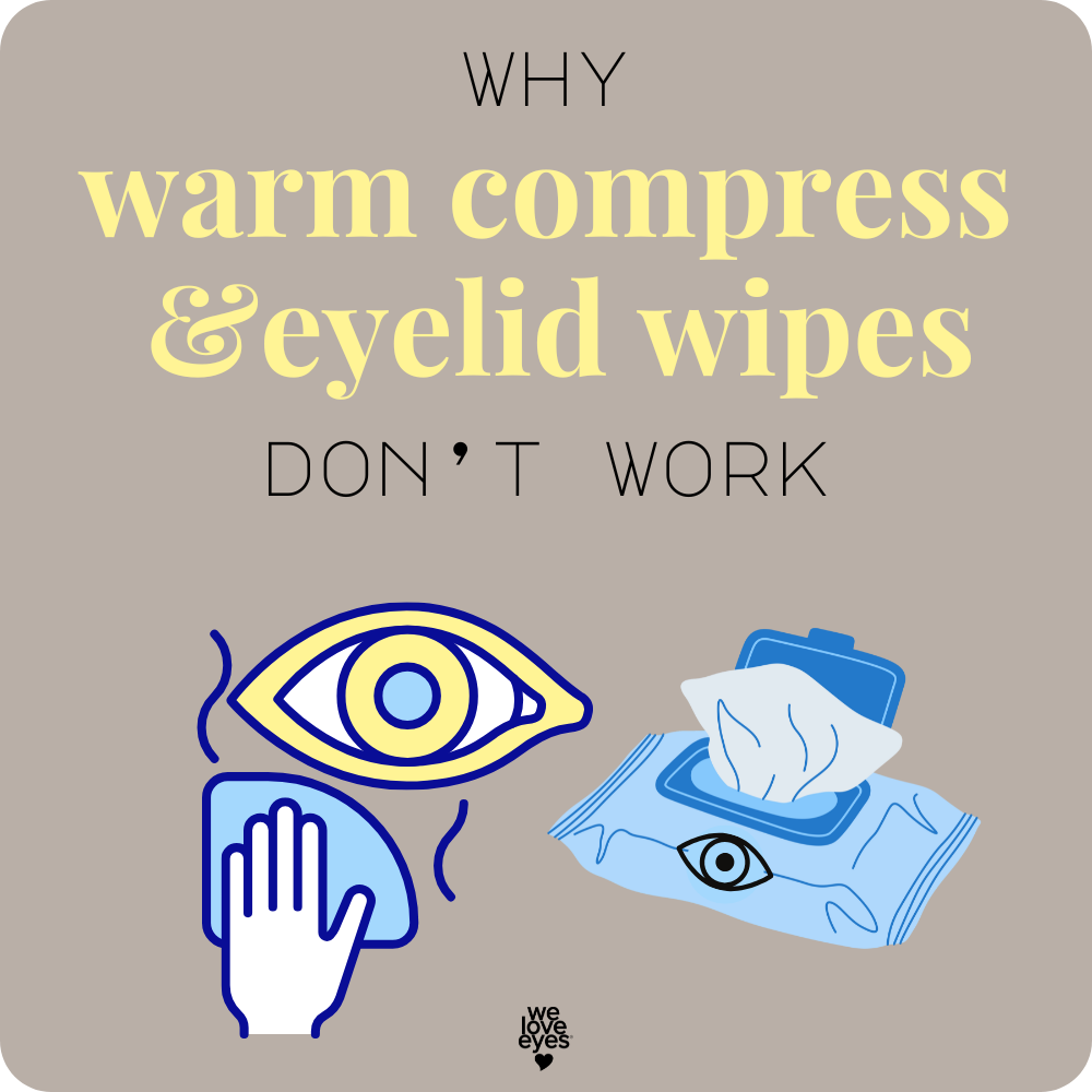 What To Do When Warm Compress & Eyelid Wipes Are No Help for Recurrent ...